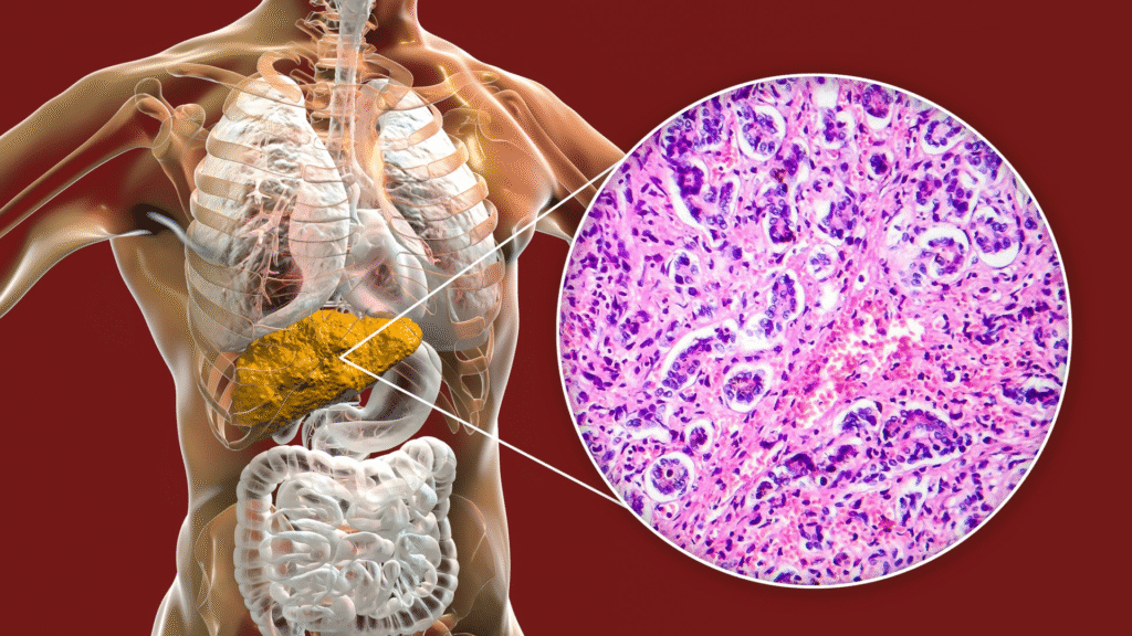 PFIC Explained - LiverRight: Virtual Liver Disease Clinic